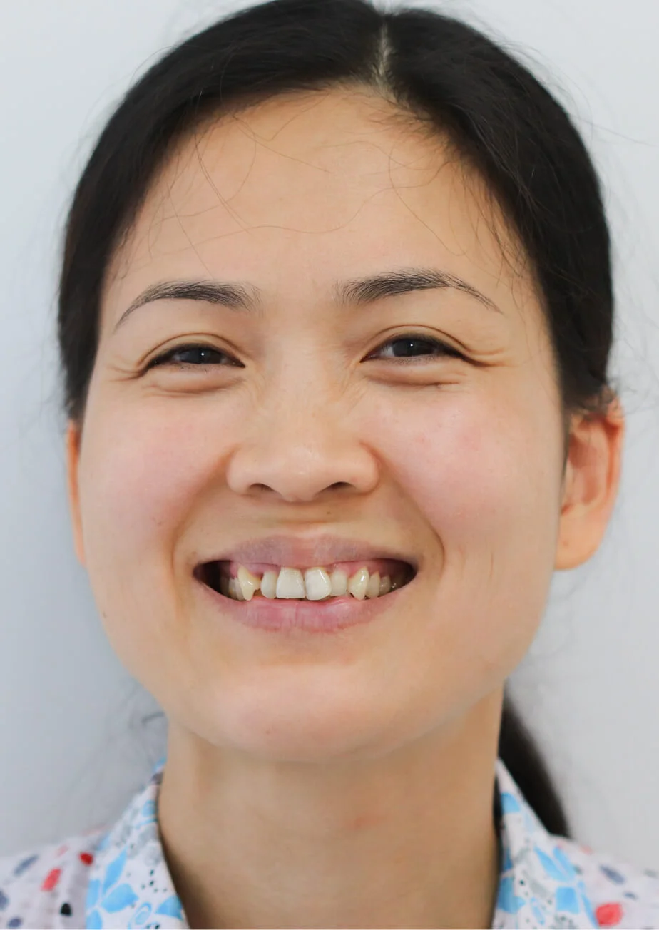 Bespoke Smiles Gallery